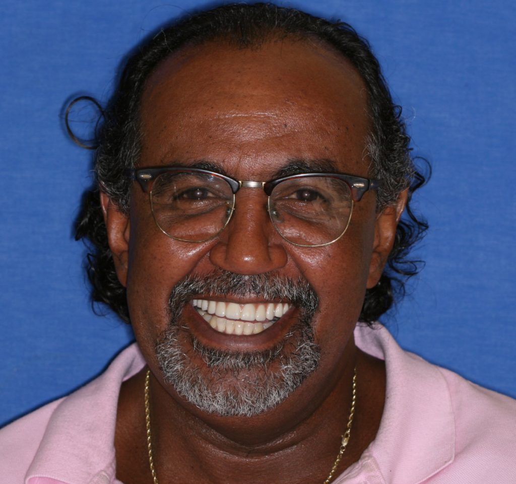 5 - Upper implant supported denture, lower implants | Juban Cowen ...